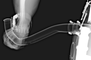 Here's how popular cycling items look through an X-Ray - Bikerumor