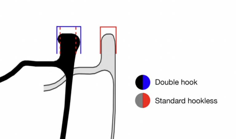 Dandy Horse lanza tecnología de llantas de doble gancho en tres juegos de ruedas para 2025 ...